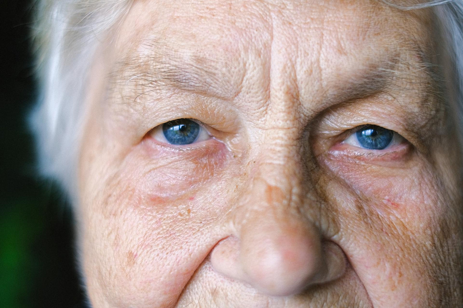 Recognizing the Early Signs of Aging: What You Need to Know – IDEO Skincare